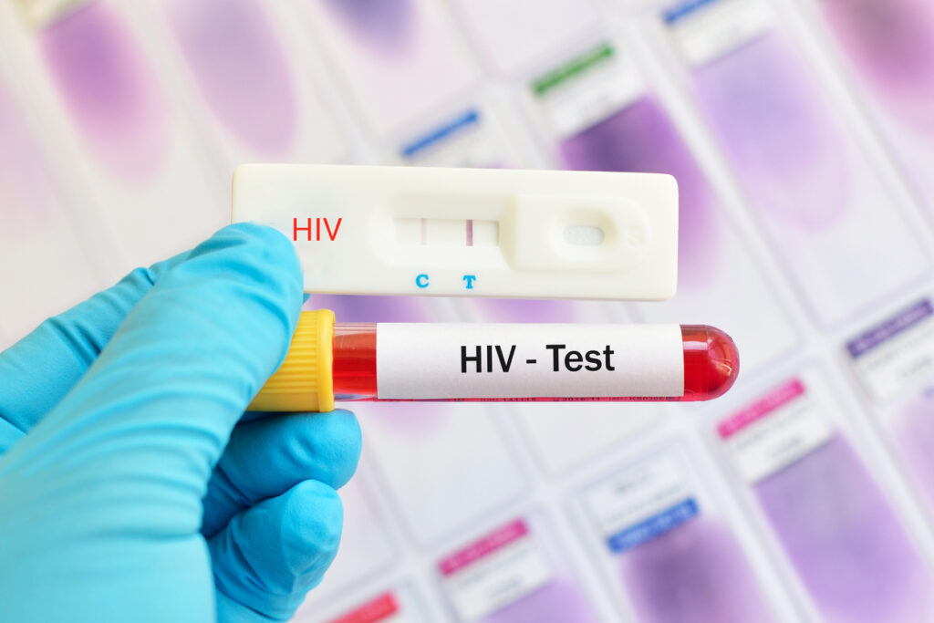 How to Read STD Test Results - The Sleeper Must Aweken